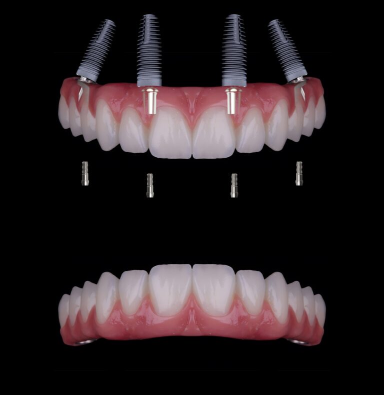 Davis Oral Surgery and Implant Center | Davis, CA